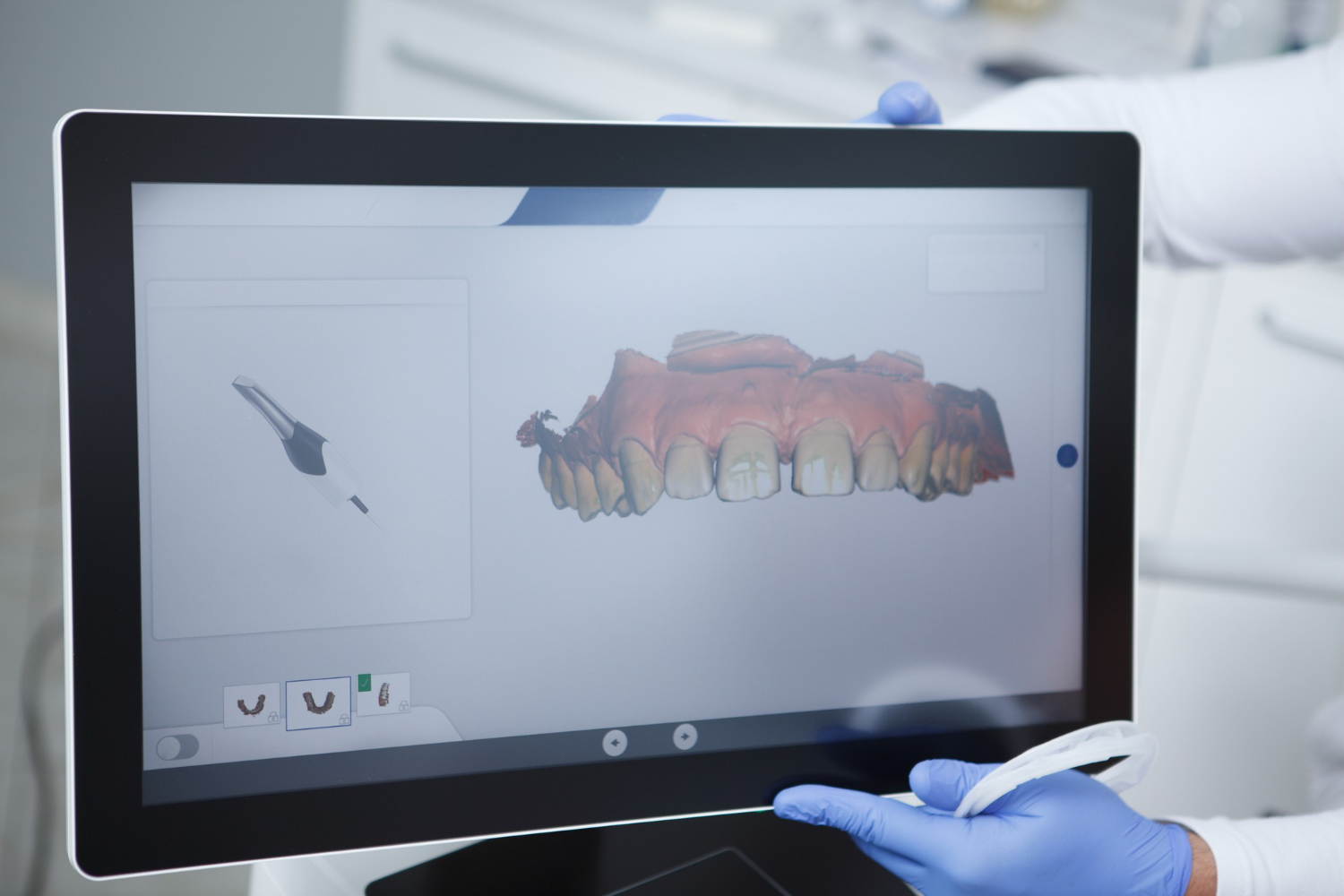 Digital Dentures – Novo Lab
